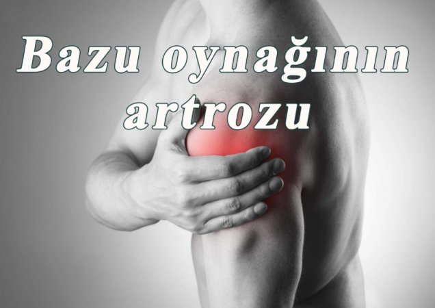 Bazu oynaginin artrozu